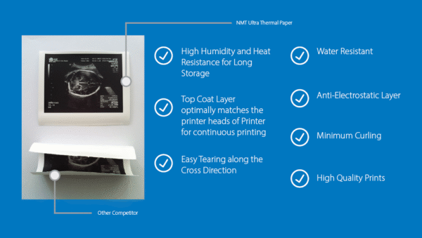 Sonography Tools: How to Choose the Right Ultrasound Paper